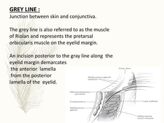 Surgical anatomy of eyelid | PPTX