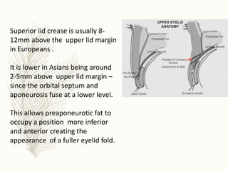 Surgical anatomy of eyelid | PPTX