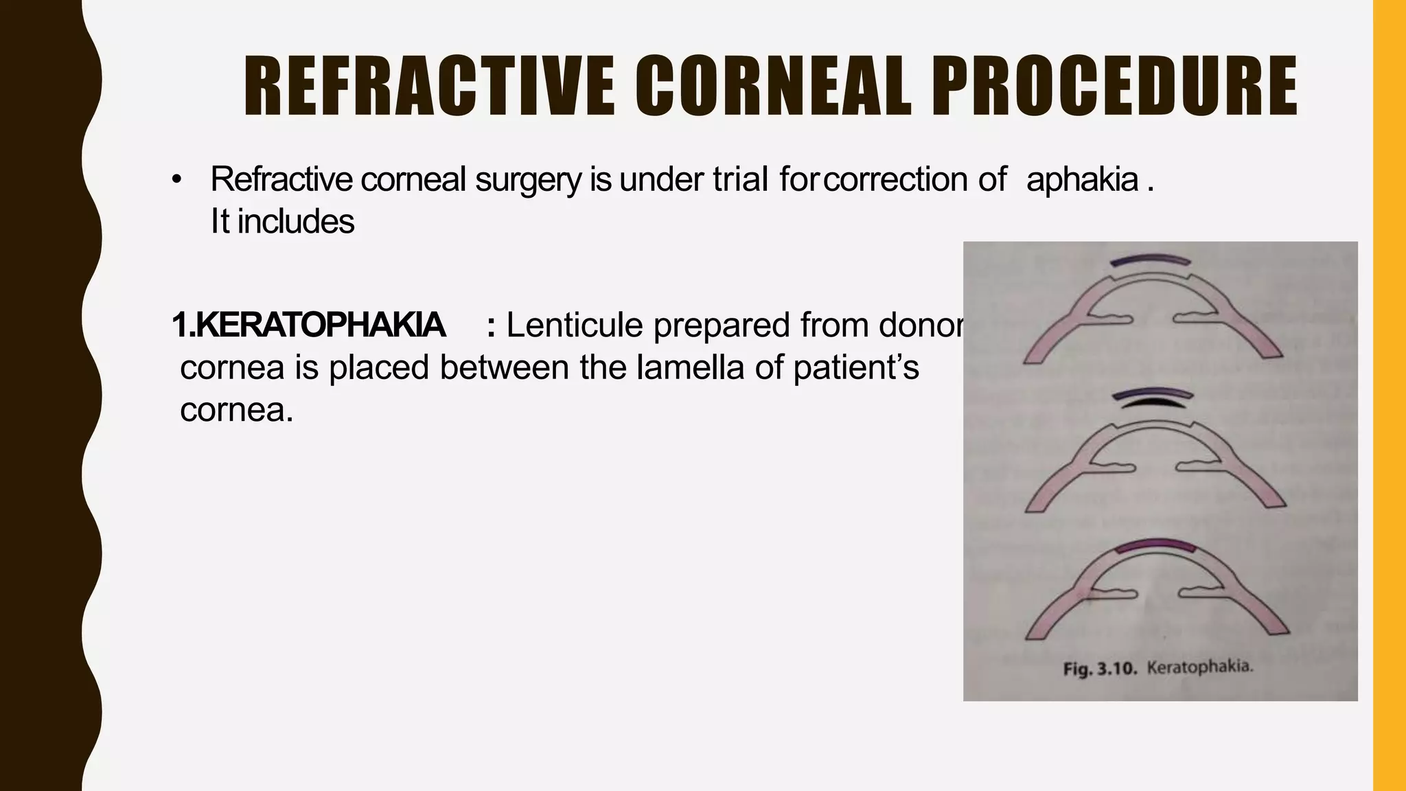 Aphakia | PPTX | Death, Injury, or Military Conflict | Sensitive Topics