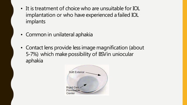 Aphakia | PPTX | Death, Injury, or Military Conflict | Sensitive Topics