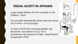 Aphakia | PPTX