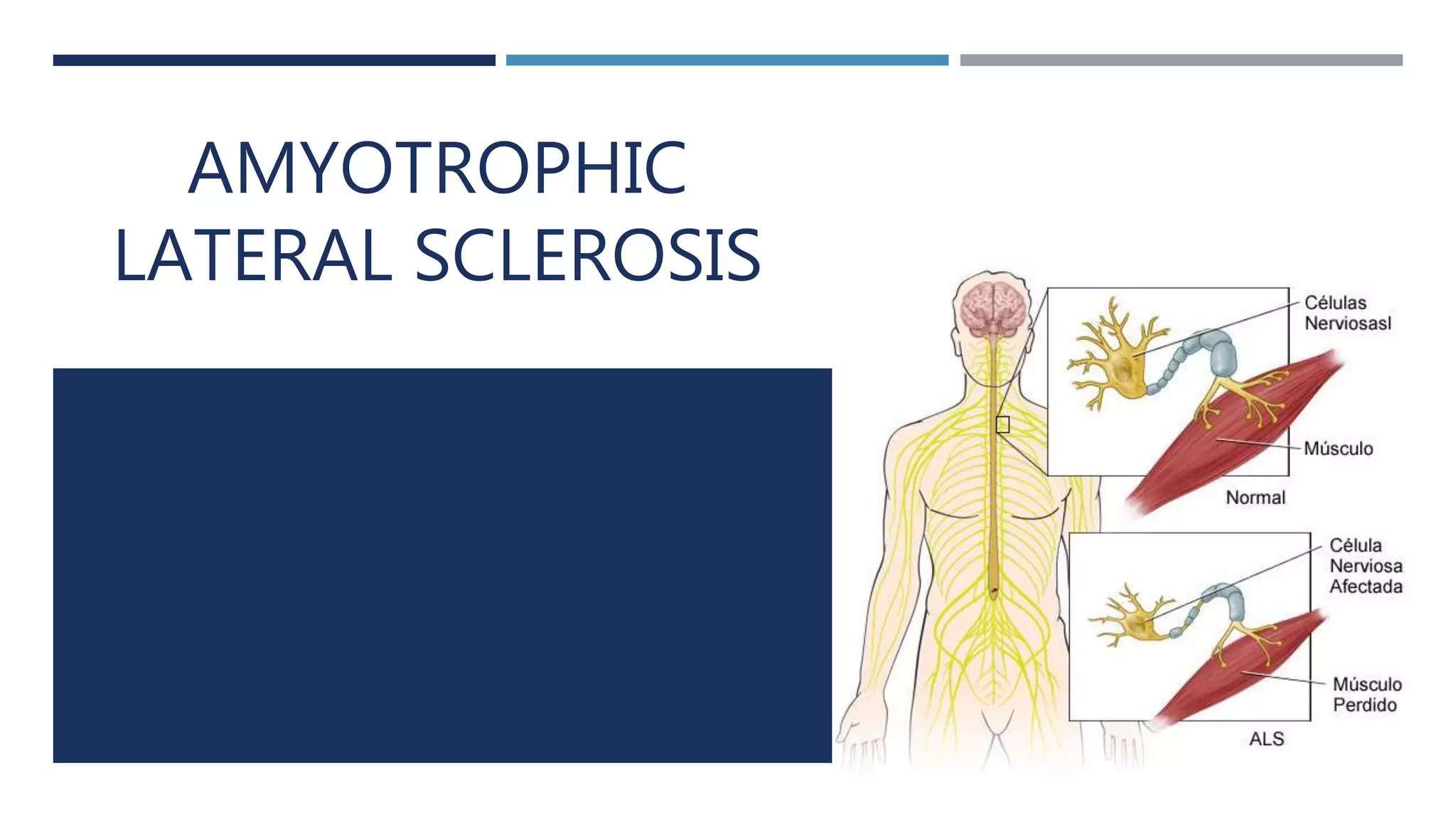 Amyotrophic Lateral Sclerosis | PPTX