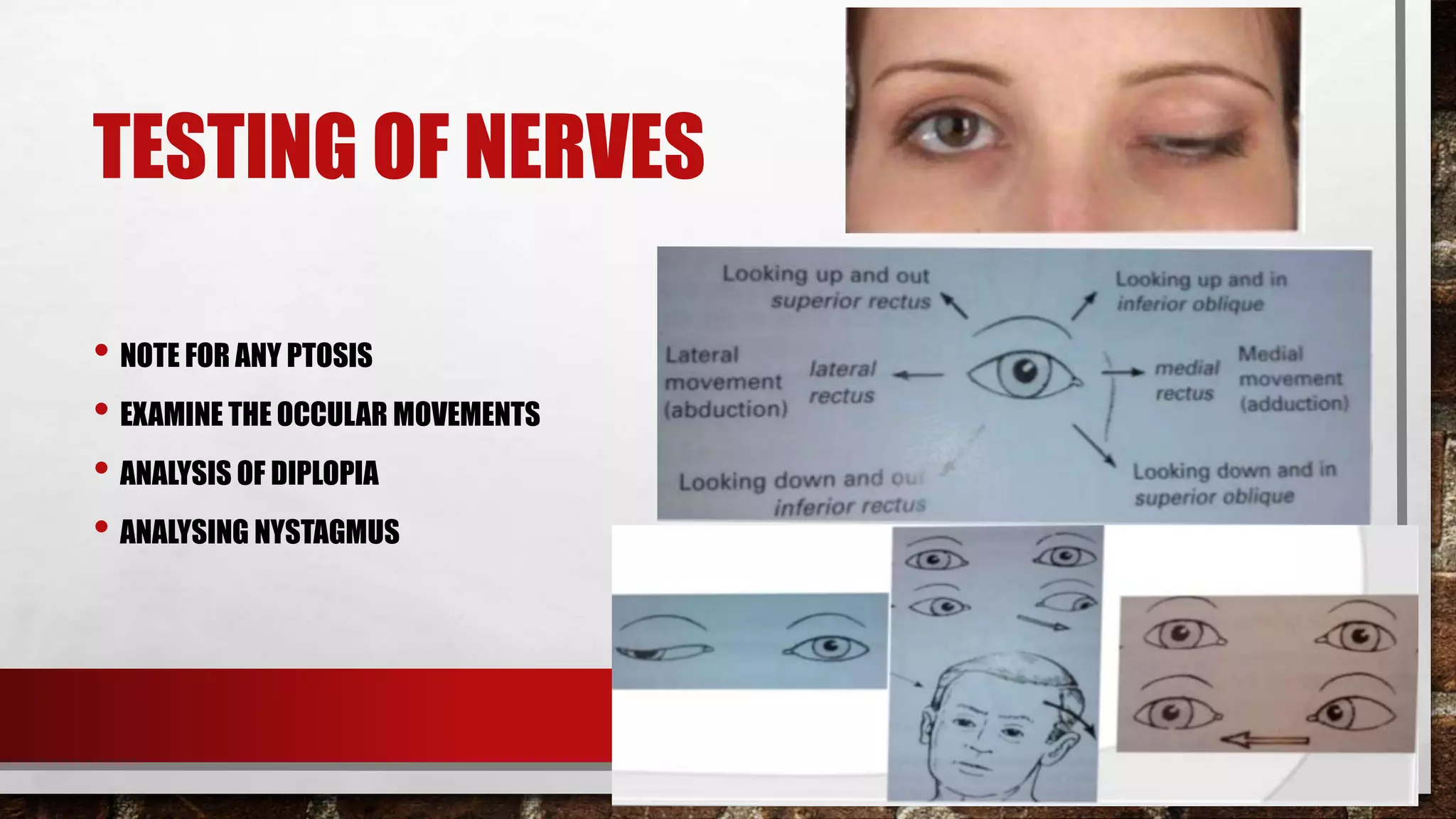 3rd, 4rth, 6th, cranial nerves or occulomotor, trochlear, abducence ...