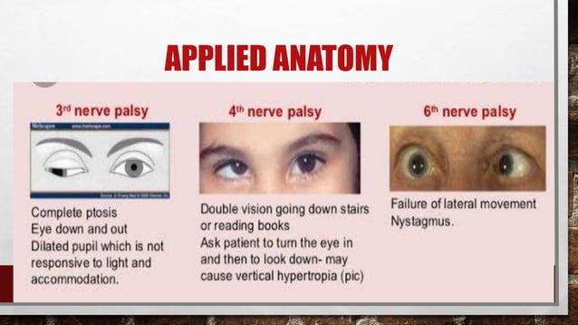 3rd, 4rth, 6th, cranial nerves or occulomotor, trochlear, abducence ...