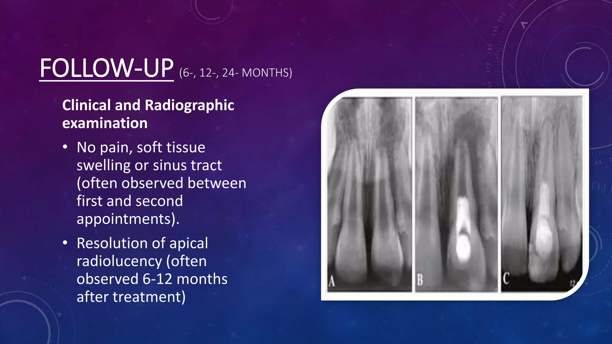 Pulp Revascularization.pptx