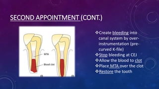 Pulp Revascularization.pptx
