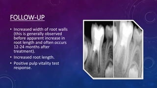 Pulp Revascularization.pptx