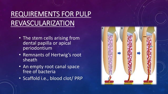 Pulp Revascularization.pptx