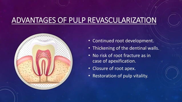 Pulp Revascularization.pptx
