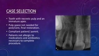 Pulp Revascularization.pptx