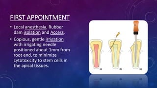 Pulp Revascularization.pptx