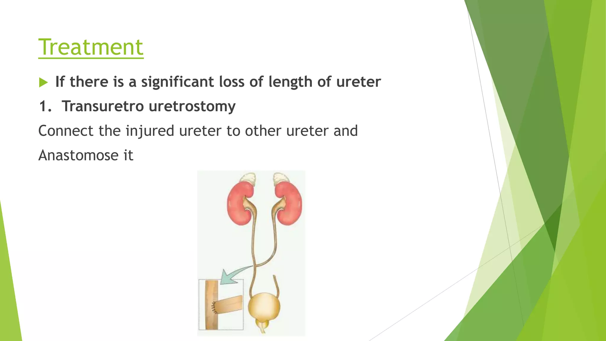 URETERAL INJURY.ppt