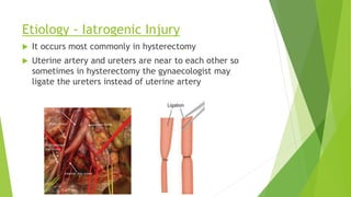 URETERAL INJURY.ppt