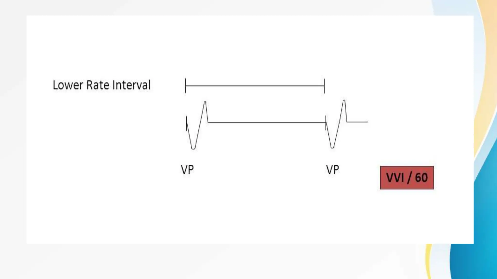 Permanent pacemaker cycle length. Managent | PPT | Free Download