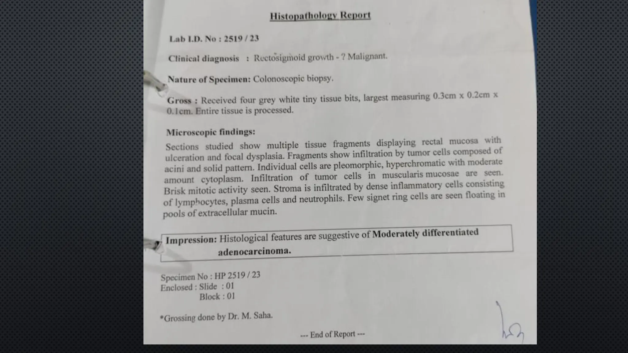 Clinical case scenario of ca rectum.pptx