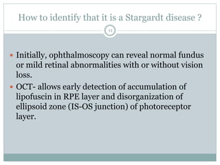 Stargardt disease and low vision management. | PPTX