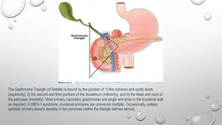 Zollinger Ellison Syndrome | PPTX