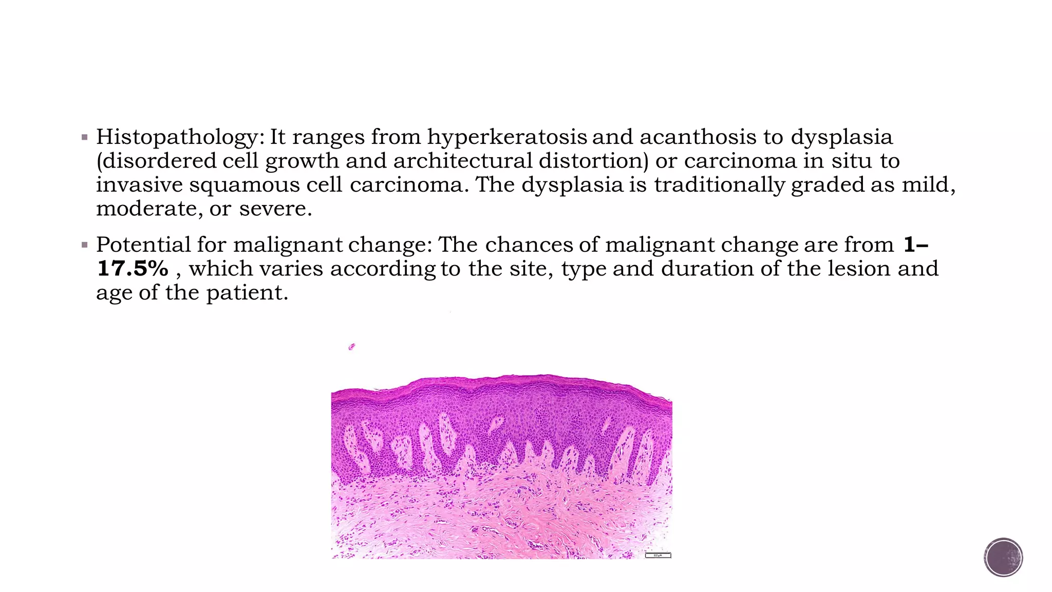 Oral Potentially Malignant Disorders | PDF