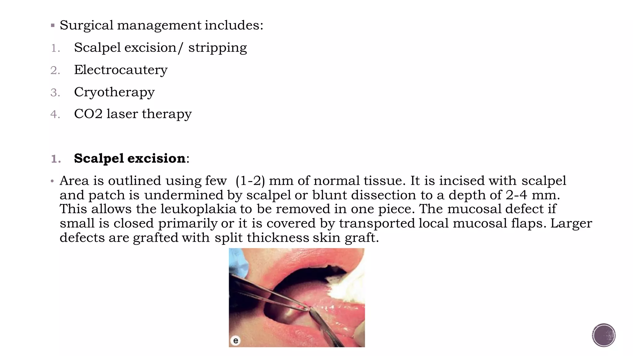 Oral Potentially Malignant Disorders | PDF