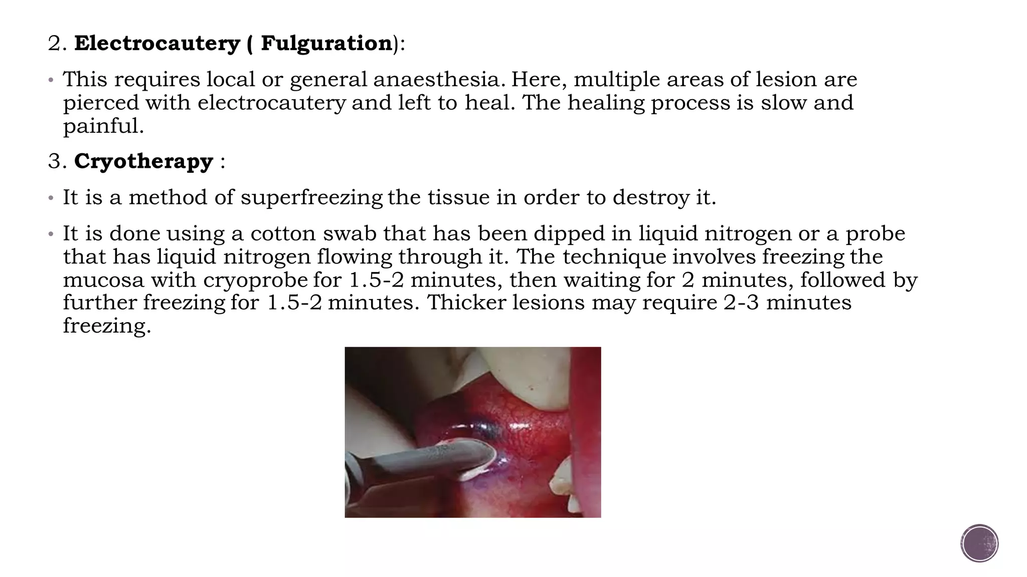 Oral Potentially Malignant Disorders | PDF
