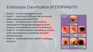 GASTRO ESOPHAGEAL REFLUX DISEASE (GERD) | PPT