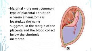 DOC-20230703-WA0001..pptx