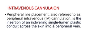 IV CANNULION | PPT