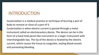 Thermal cautrization | PPT