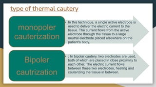Thermal cautrization | PPT