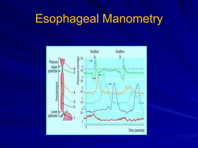 Esophageal motility disorder.pdf