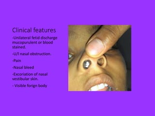 Foreign body nose..pptx