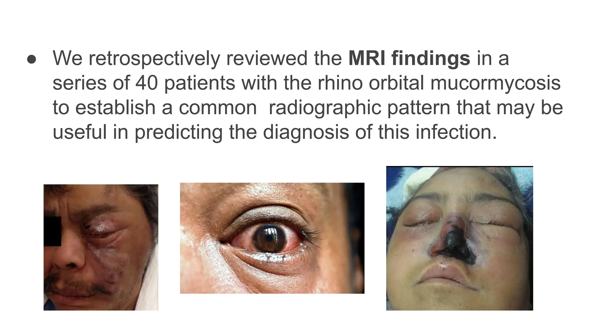 Mucormycosis radiological evidence in ct and mri | PDF