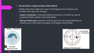primaary open angle glaucoma presentation | PPTX