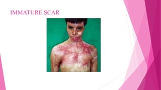 Post burn scar and scar contracture. | PPTX