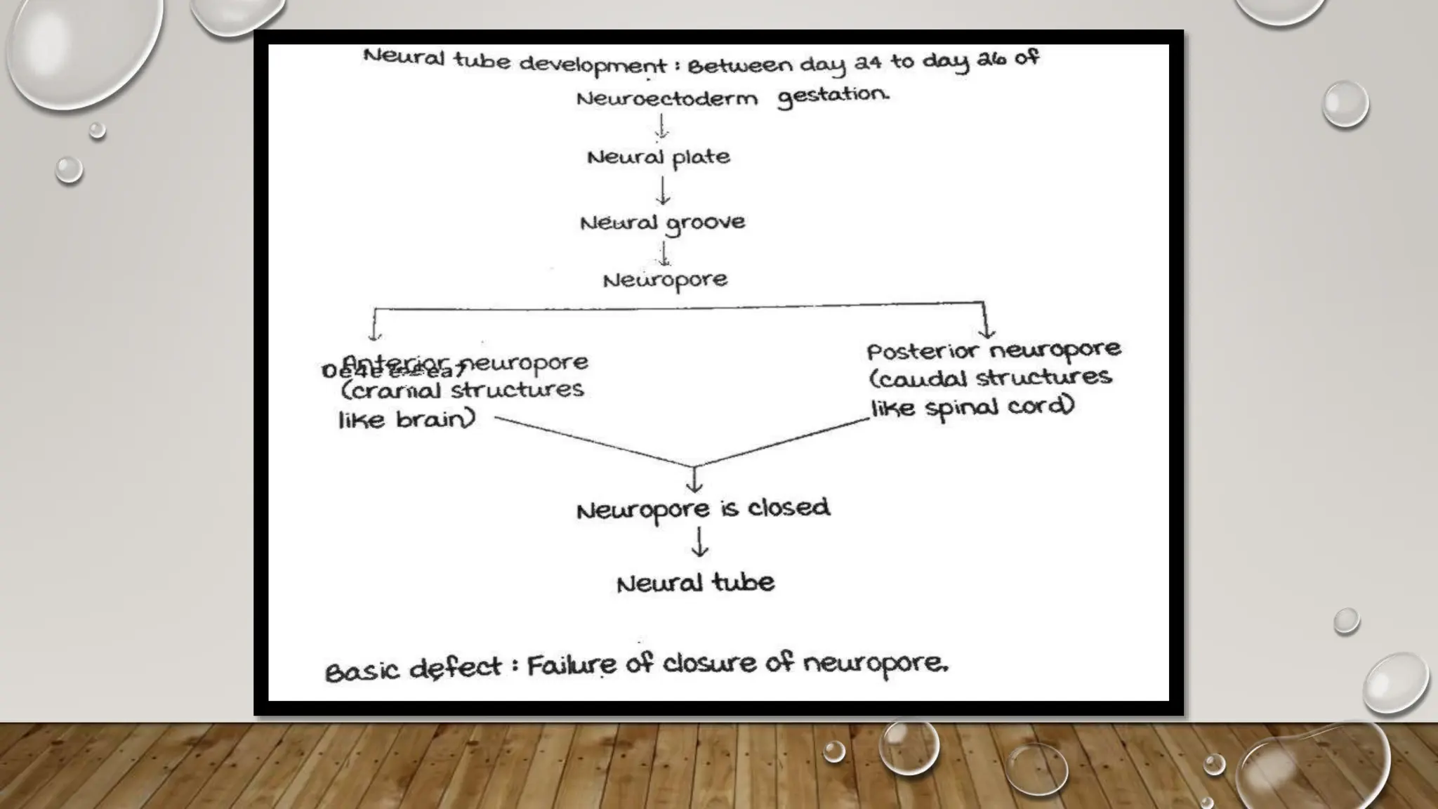 Neural tube defect | PPTX