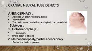 Neural tube defect | PPTX
