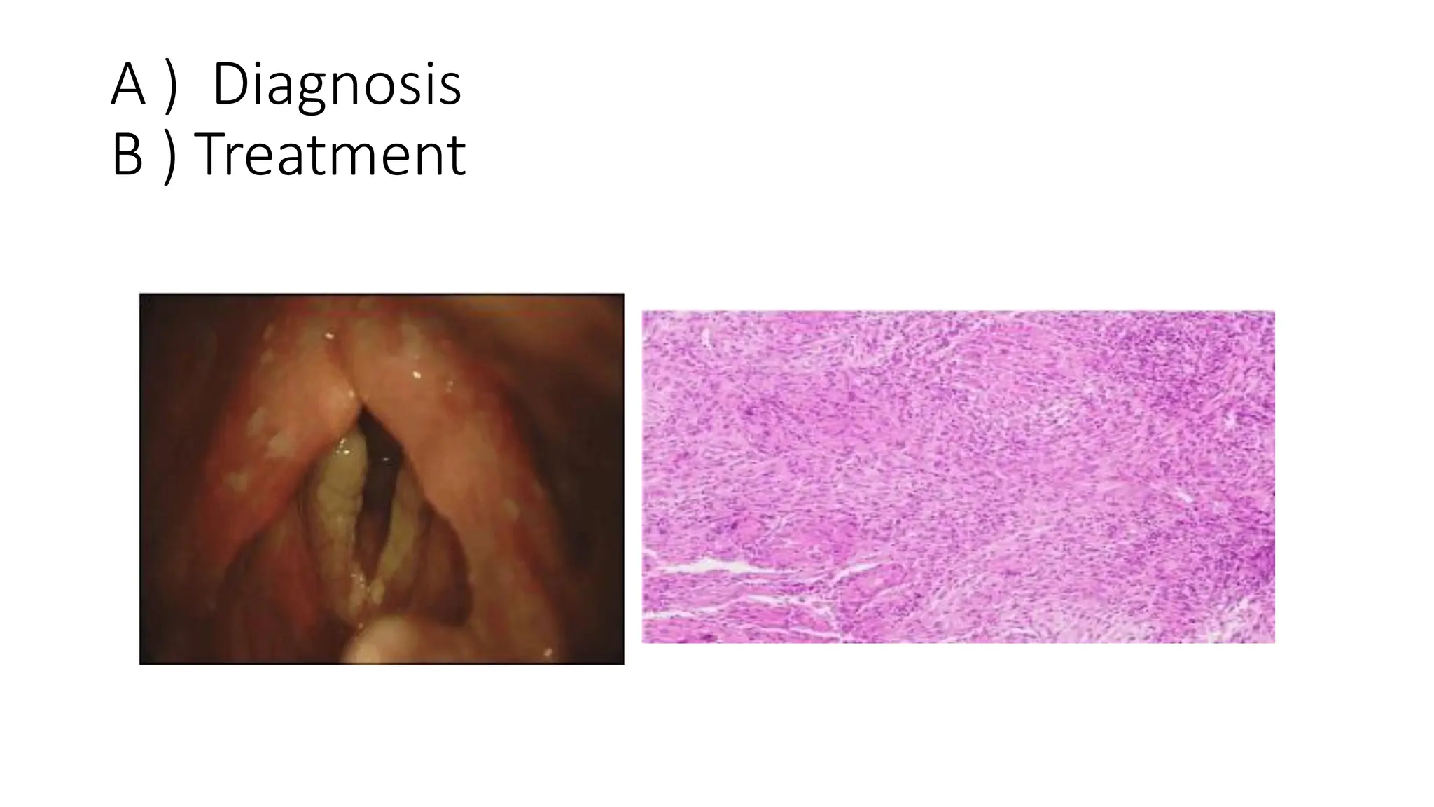 Otorhinolaryngology objective structural clinical examination | PDF
