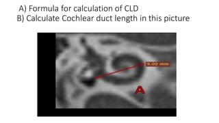 Otorhinolaryngology objective structural clinical examination | PPT