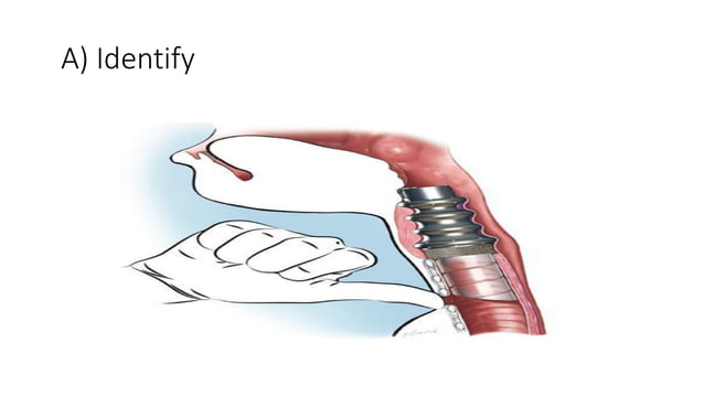 Otorhinolaryngology objective structural clinical examination | PPT