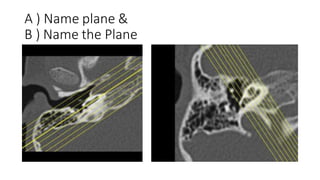 Otorhinolaryngology objective structural clinical examination | PPT