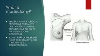 MASTECTOMY PROCEDURES NOTES PRESENTATION | PDF