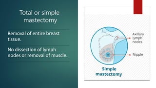 MASTECTOMY PROCEDURES NOTES PRESENTATION | PPT
