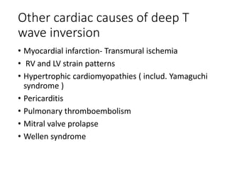 ECG of the week | PPT
