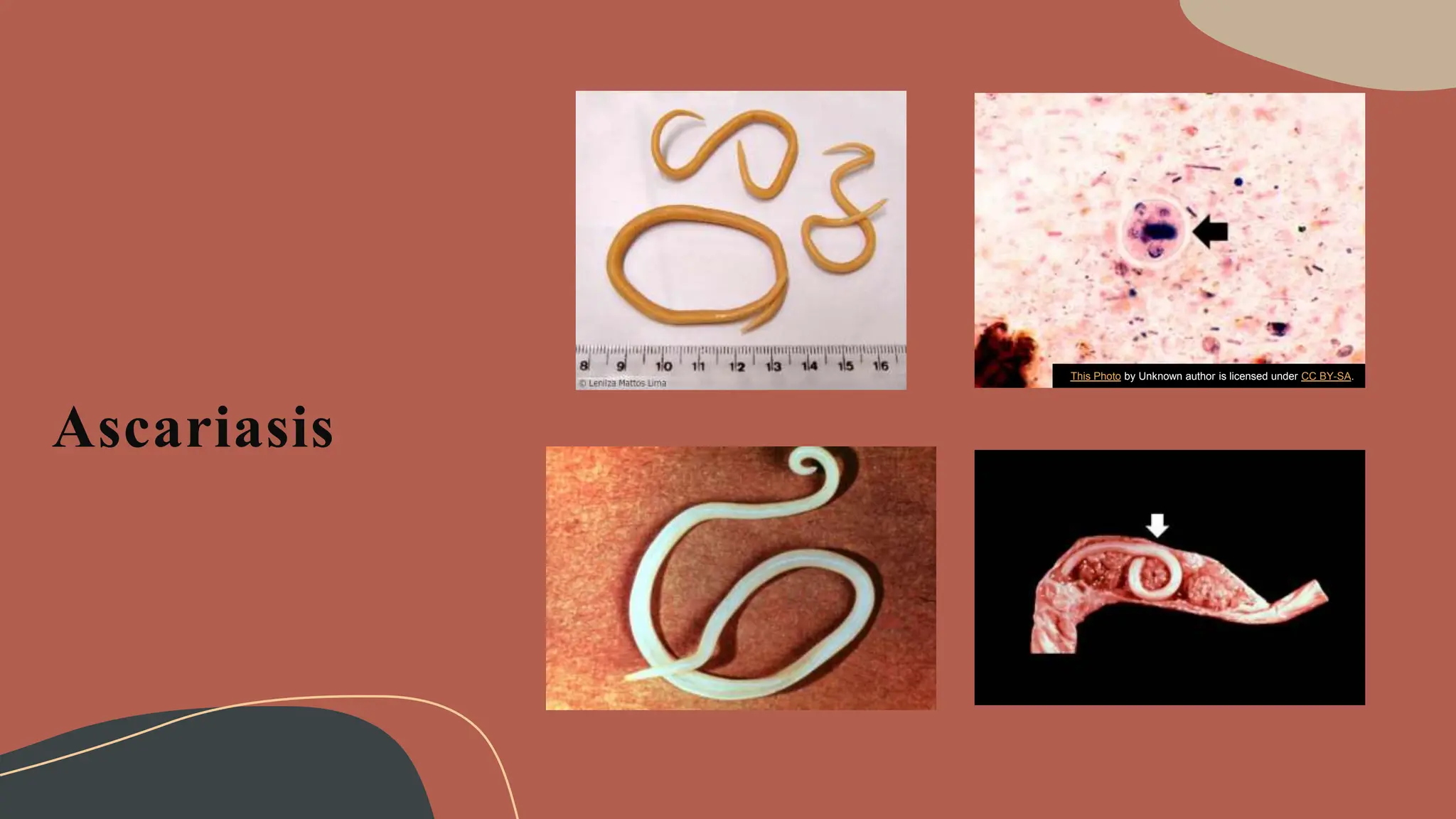 Ascariasis, Department of Physiotherapy, SHUATS, Prayagraj | PPTX