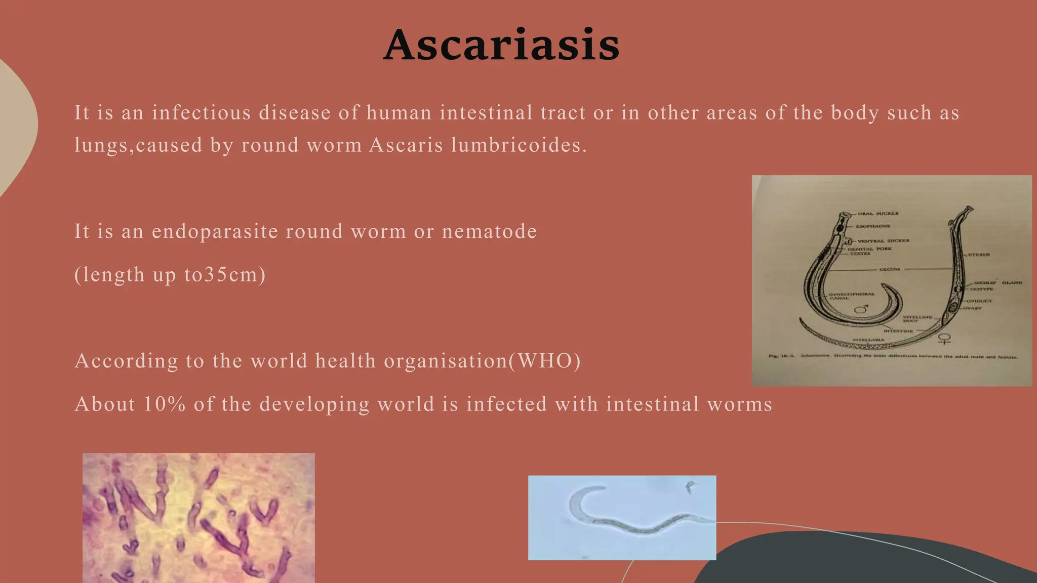 Ascariasis, Department of Physiotherapy, SHUATS, Prayagraj | PPTX