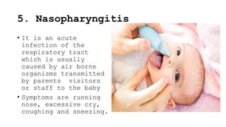 Minor disorder of newborn child health nuring | PPTX