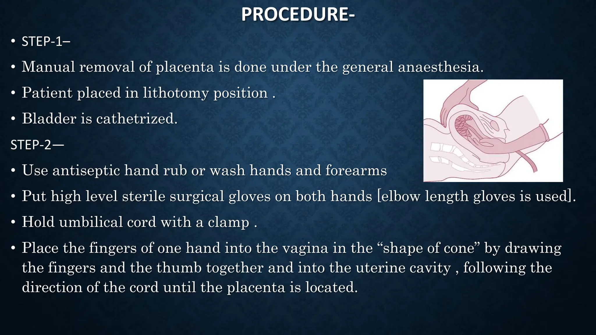 Manual removal of placenta ......ppt by sanjna thakur | PPTX