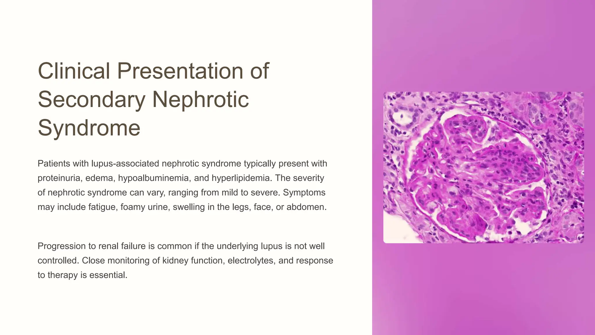 DOC-20240428-WA0004..pptx nephritis syndrome | PPT
