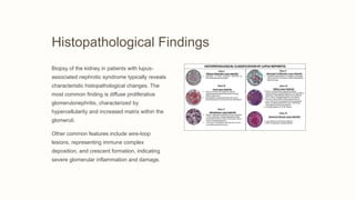 DOC-20240428-WA0004..pptx nephritis syndrome | PPT