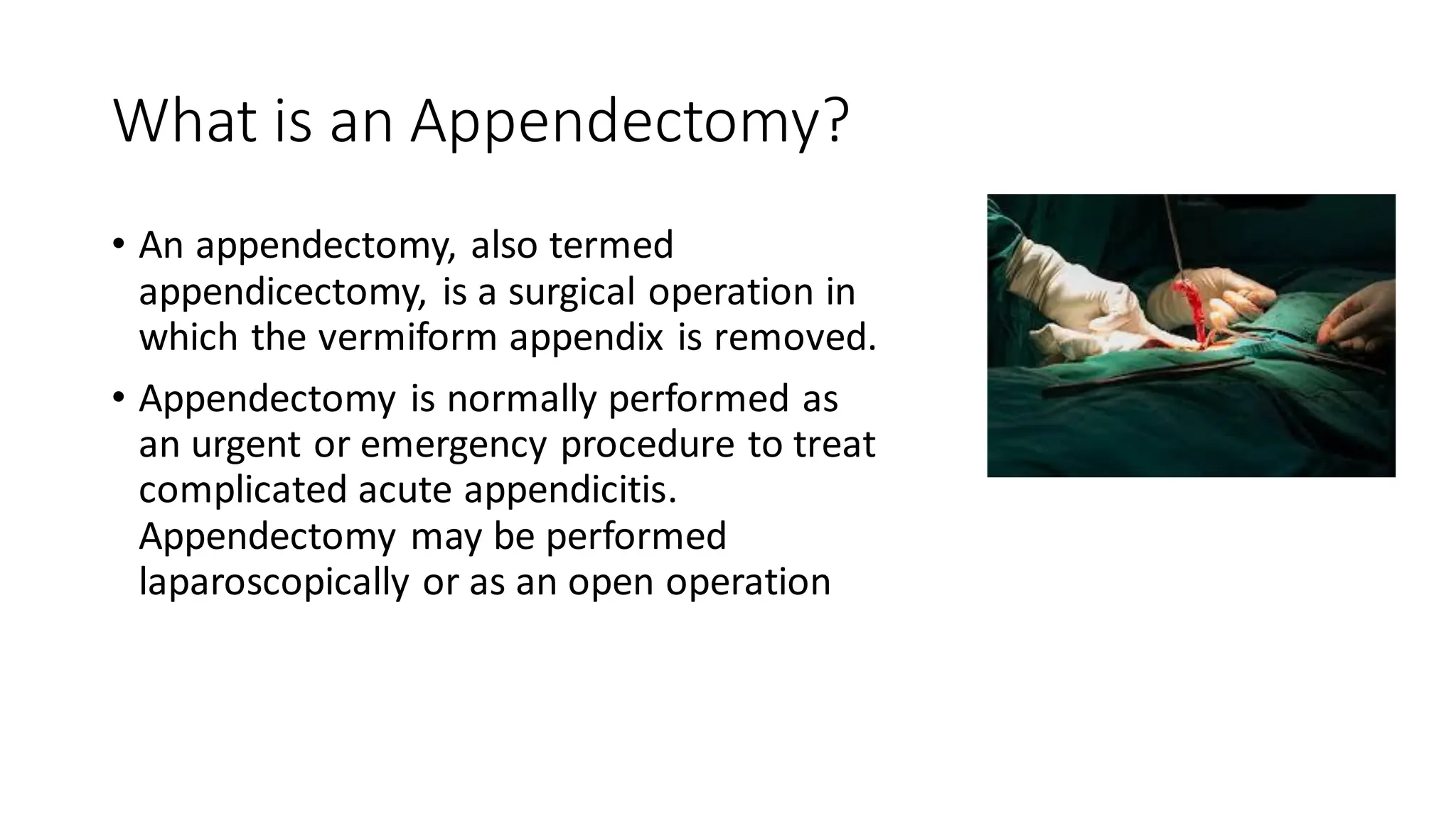 APPENDECTOMY PRESENTATION BY GENERAL SURGERY | PDF